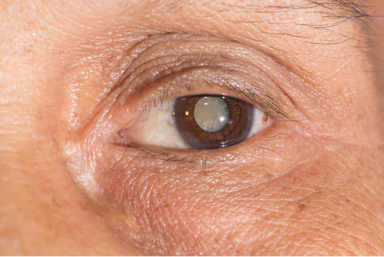 Common Eye Problems In The Elderly: Stats, Facts, and Data You Need to ...